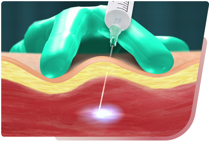 Non-Surgical Solutions for Treating Pain